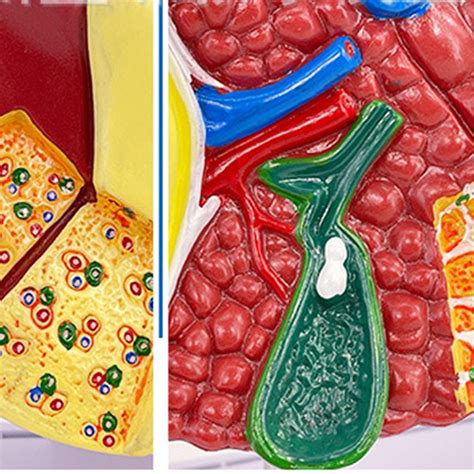 Liver Model For Common Pathologies Liver Model Human Anatomy Doctor