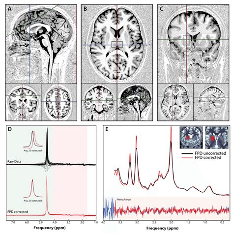 Voxel Localization And Spectral Data Preprocessing Console Screenshots Download Scientific