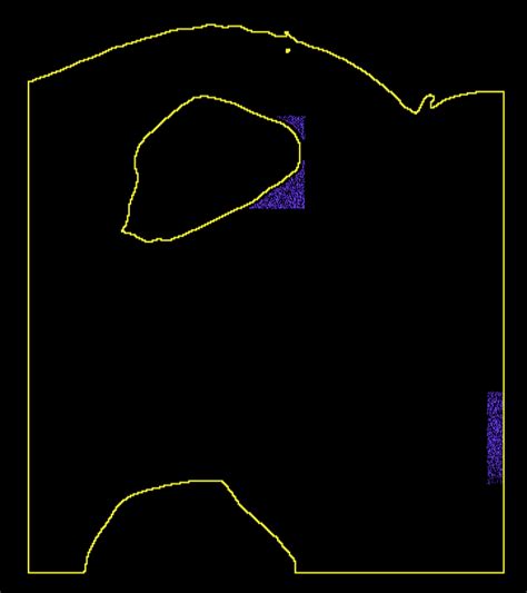 Qupath Stardist Extension Error With Large Images Usage And Issues Imagesc Forum