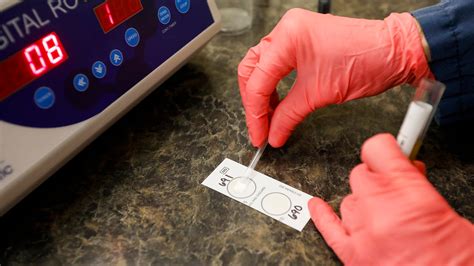 Syphilis Prevention Act Would Combat The Disease In Pregnant Women