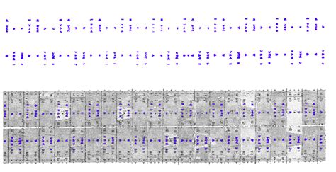 Development Of A Mobile Laser Measurement System For Subway Tunnel Deformation Detection