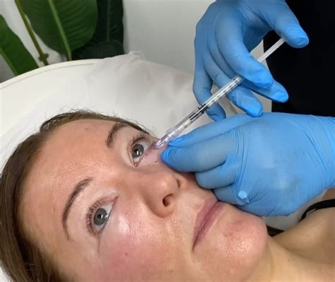 Nctf Skin Booster Treatment Brisbane