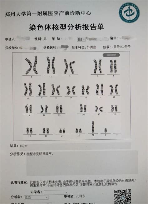 Dxqxpt