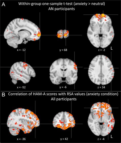 Representational Similarity Analysis Results A Within Group One Sample Download Scientific