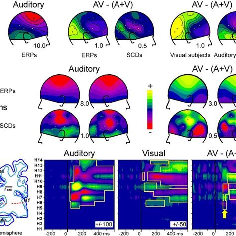 Pdf Electrophysiological Eeg Seeg Meg Evidence For Multiple