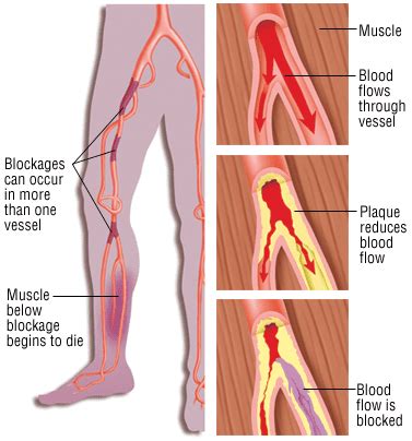 Peripheral Vascular Assessment
