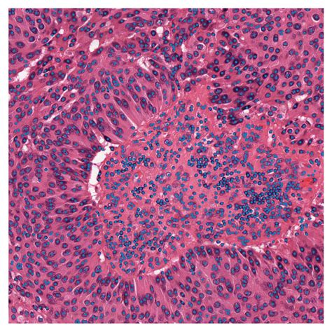 Patch Extraction From Histology Images Tia Toolbox 151 Documentation