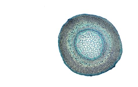 Anatomic Pathology Analyze Pathology