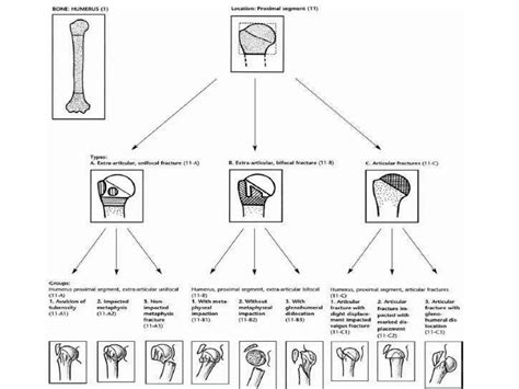 Proximal Humerus Fractures Pptx