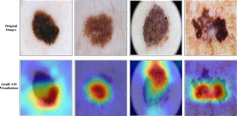 A Novel Framework Of Multiclass Skin Lesion Recognition From