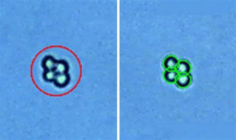 The History Of Automated Cell Counting A Journey From Coulter Counters To Image Based Cell