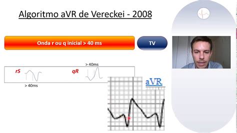 Aplicando Critérios De Vereckei Avr Youtube