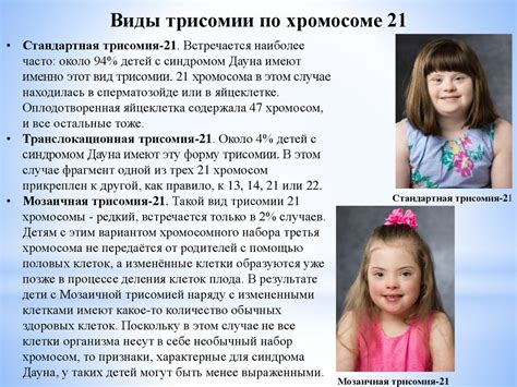 Синдром Дауна презентация онлайн