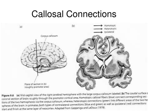 Ppt Homotopic Callosal Connections Powerpoint Presentation Free