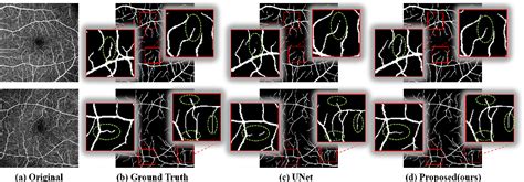 Figure 1 From Multi Scale Retina Vessel Segmentation In Octa With A Vascular Connectivity Module