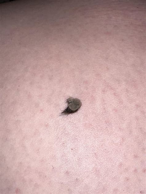 Cat Scab Rcathelp