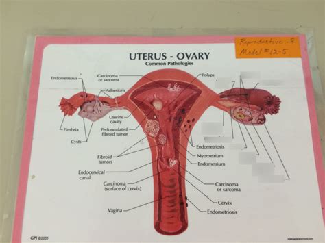 Uterus Diagram Quizlet