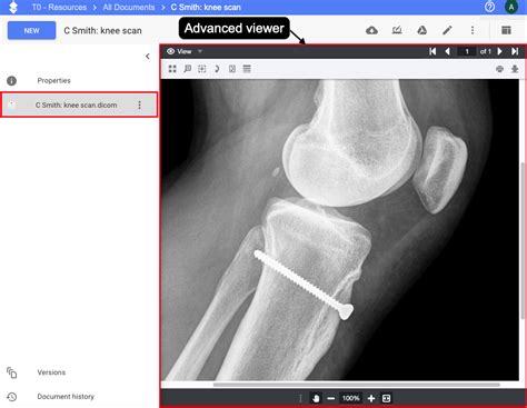 Preview Attached Files Aodocs Knowledge Base