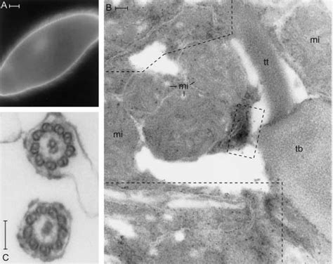 Immunolocalization Of PP C In Formaldehyd Fixed Paramecium By Download High Resolution