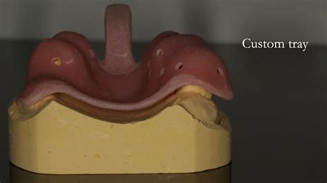 Newsletter 71 Jeans Class I Mod Iii Rpd See My Mistakes Fractured Mk1