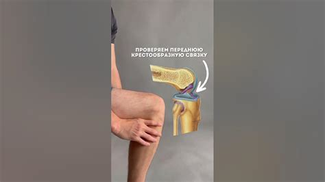 რევმატოლოგი ირაკლი შელია სახსარშიდა ინექცია Youtube