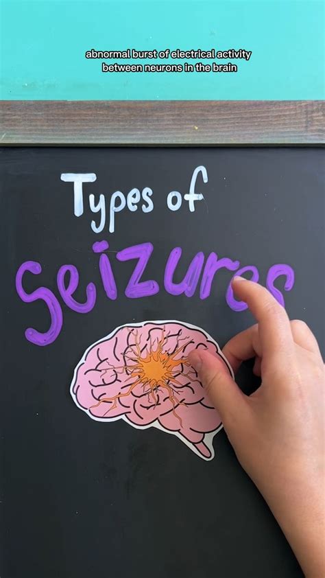 ⚡️seizure Types Explained Medical School Essentials Nursing School Survival Nursing School Tips