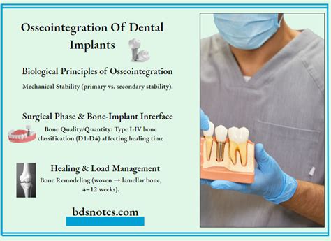 Osseointegration Of Dental Implants Bds Notes