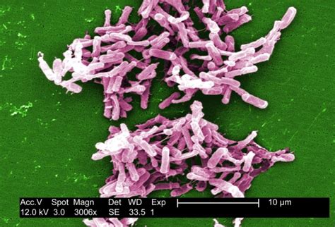 Stool Transplants Are Now Standard Of Care For Recurrent C Difficile