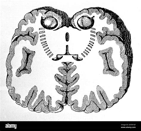 Brain Coronal Section High Resolution Stock Photography And Images Alamy