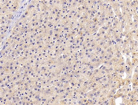 β 半乳糖苷酶染色