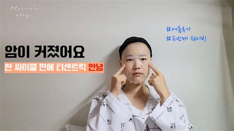 30대 유방암 4기 환자 Vlog 항암제 변경 암이 커졌어요 여름 휴가 두번째 쉐이빙 티센트릭 아브락산 비용 부작용 Youtube