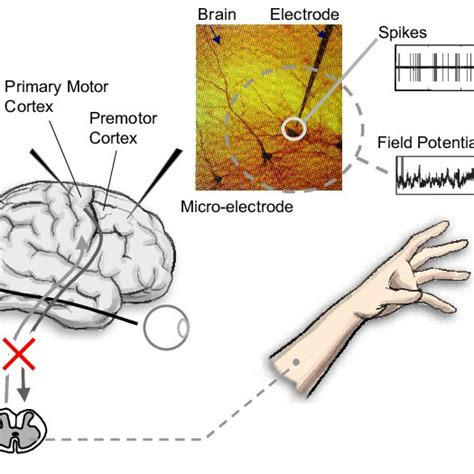 Pdf Cognitive Based Neural Prosthetics