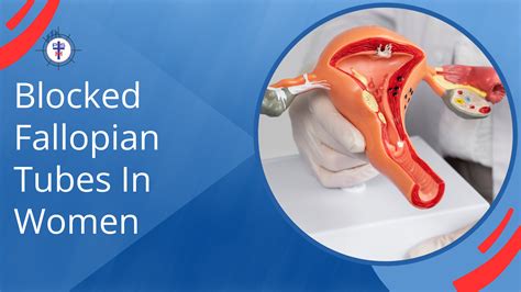 The Point Specialist Hospital Blocked Fallopian Tube In Women