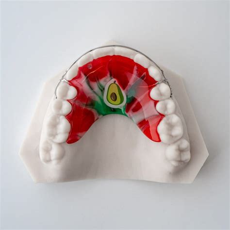 Hawley With Welded C Clasps Odl Orthodontic Labs