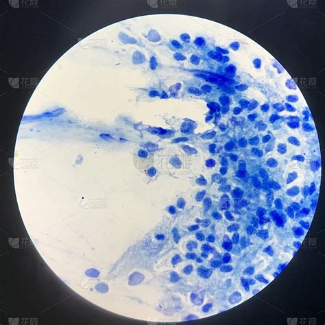 结核病细胞素材 花瓣网