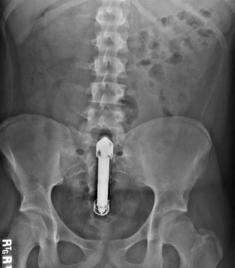 Sex Toys Xrays Buyxraysonline