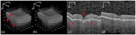 A 3d Oct Volume With Axial Motion Artifacts Indicated With Red