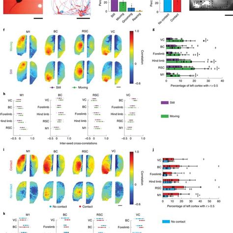 Combined Electrophysiological Recording And Mesoscale Imaging Of Brain Download Scientific