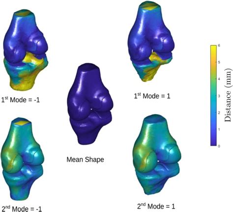 Real Time Musculoskeletal Kinematics And Dynamics Analysis Using Marker