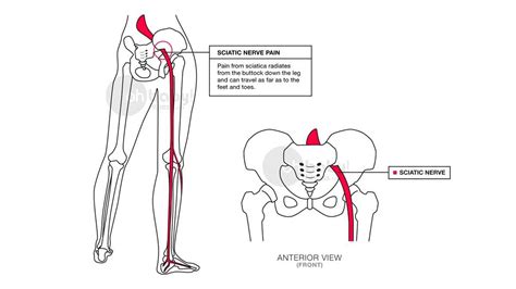 The Route Of The Sciatic Nerve Explained In A Diagram