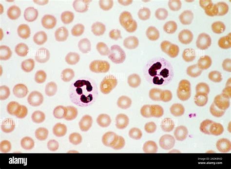 Light Micrograph Showing Two Neutrophils The Most Common Type Of