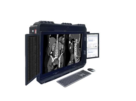 Radcom Full Spec 32 Portable Radiology Station Rad Made Simple