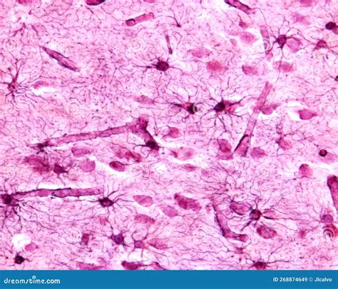 Astrocytes Histology