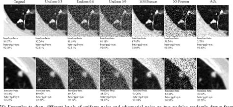 Lung Nodule Detection Models Code And Papers Catalyzex