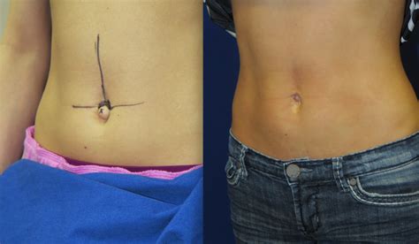 Belly Button Piercing Innie