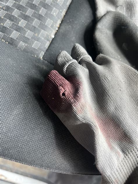 Time For A Tetanus Booster Rhvac