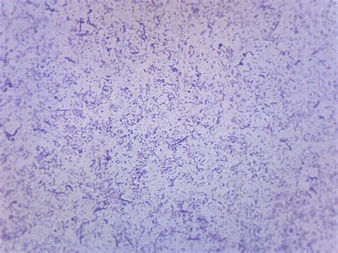 Typical Bacteria Whole Mount Prepared Microscope Slide Microscope
