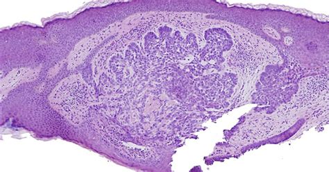 Optical Coherence Tomography Image