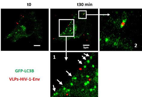 Lc3b Conjugation Machinery Promotes Autophagy Independent Hiv 1 Entry In Cd4 T Lymphocytes Cfatg