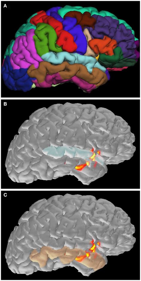 Application Of Cortical Parcellation Cortical Parcellation Is Obtained Download Scientific